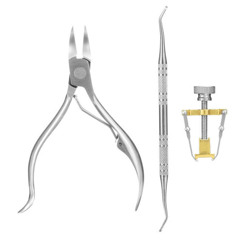 Ingrown Toenail Paronychia Armor Corrector Eagle Nail Scissors Ditch ...