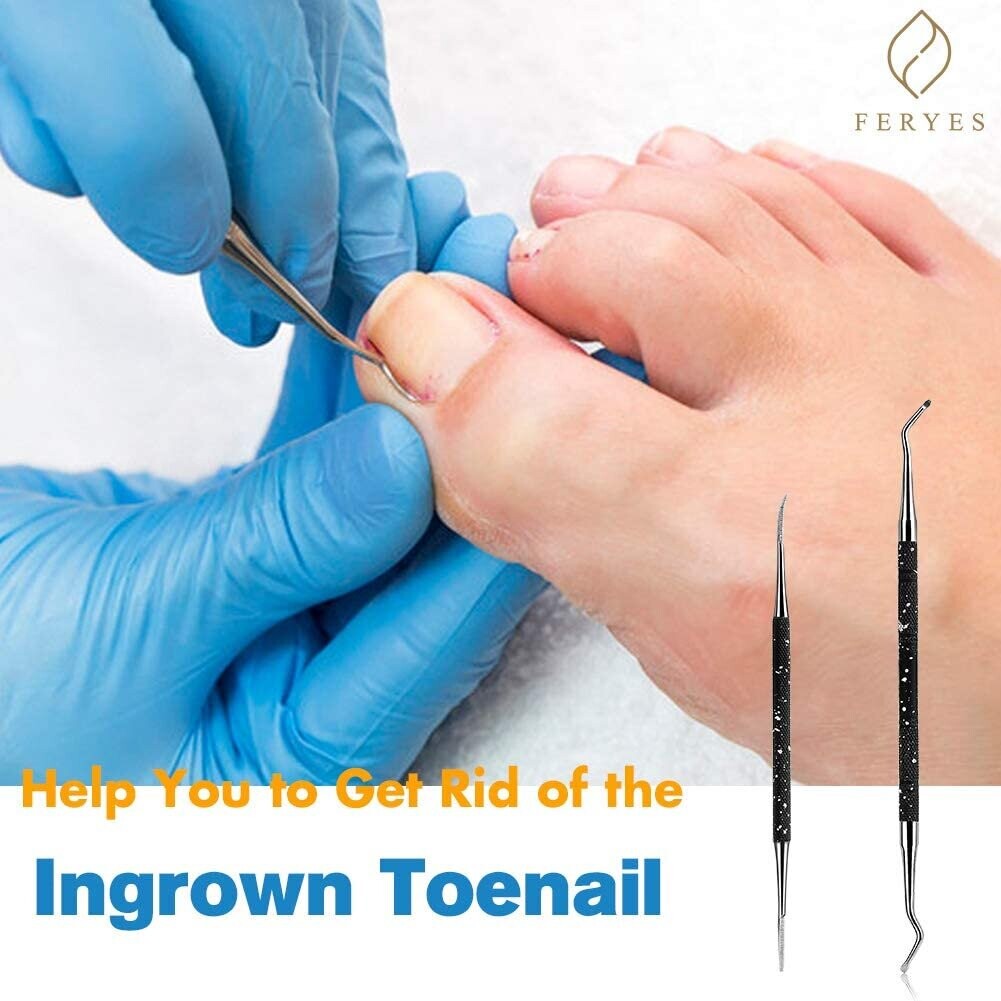 Feryes Ingrown Toenail Tools Toenail Lenter og Toenail File Set til ...
