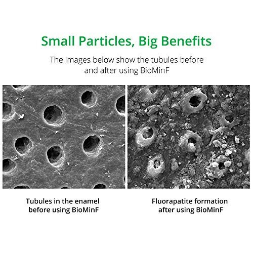 BioMin F Toothpaste (75ml) - Armour Your Teeth (x8 Tubes) to ...