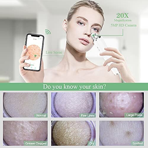 Pore vacuum with camera store