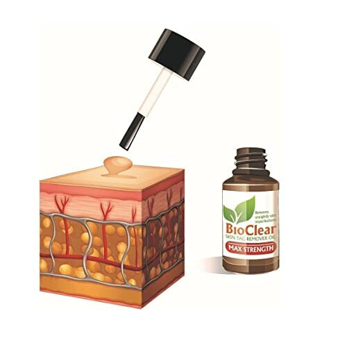 Bioclear Skin Day and Wart Removal by Bioenergiser 15 ml on OnBuy