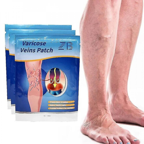 Tib 12pcs Zb Varicose Veins Patch Treatment For Varicose Veins ...
