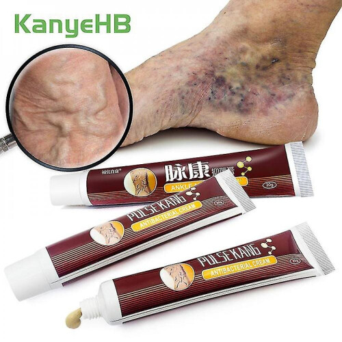 3pcs Leg Varicose Veins Relief Cream Relieve Vasculitis Phlebitis Mesh ...