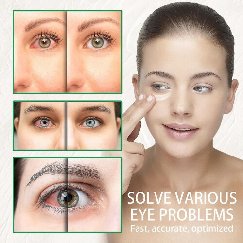South Moon Eye Ointment Relieves Dry Eyes Eye Fatigue Soreness Tightness Moisturizing