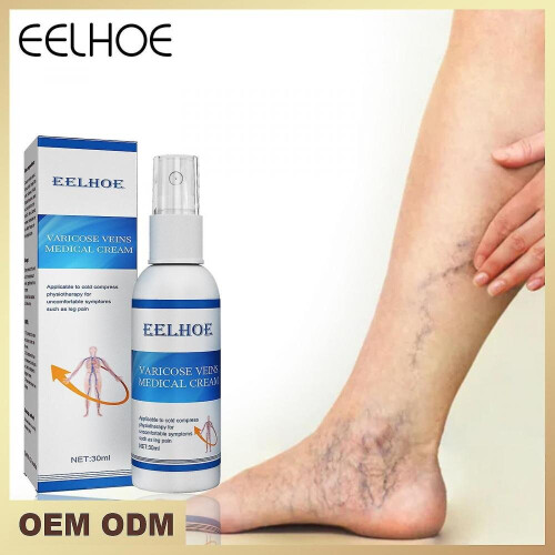 Varicose Vein Massage Spray Relieves Veins And Smoothes Earthworm Legs ...