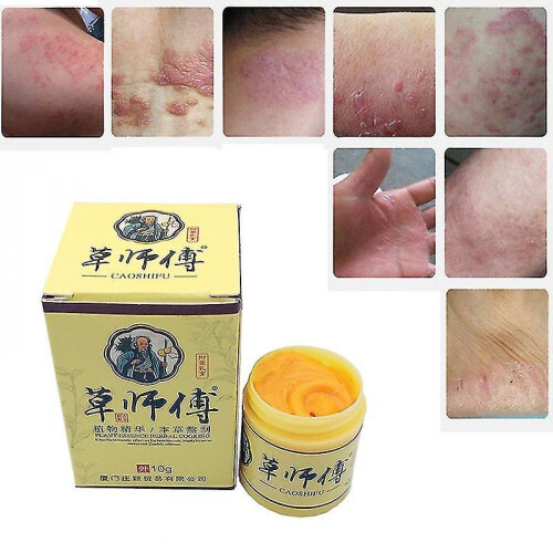2pcs 10g 29a Skin Psoriasis Cream Dermatitis Eczematoid Eczema Ointment ...