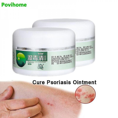 30g Eczema Psoriasis Antibacterial Treatment Ointment Dermatitis Eczema ...