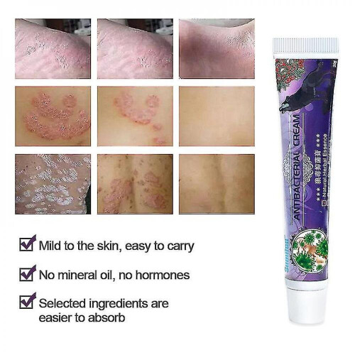 1/2/3pc Wolf Poison Psoriasis Cream Treat Eczema Dermatitis Urticaria ...