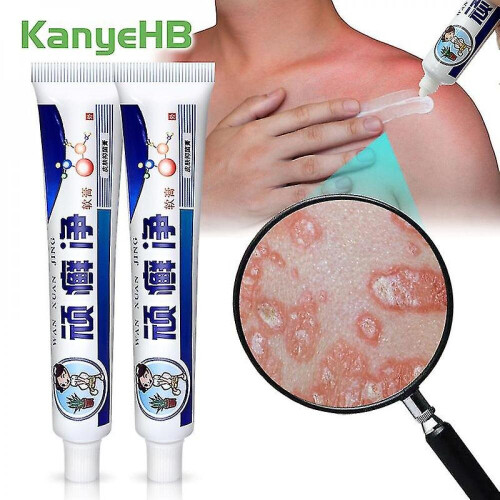 2pcs Psoriasis Dermatitis Cream Inhibit Fungi Anti-itch Treat Rash ...