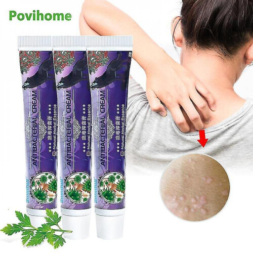 1/2/3pc Wolf Poison Psoriasis Cream Treat Eczema Dermatitis Urticaria ...