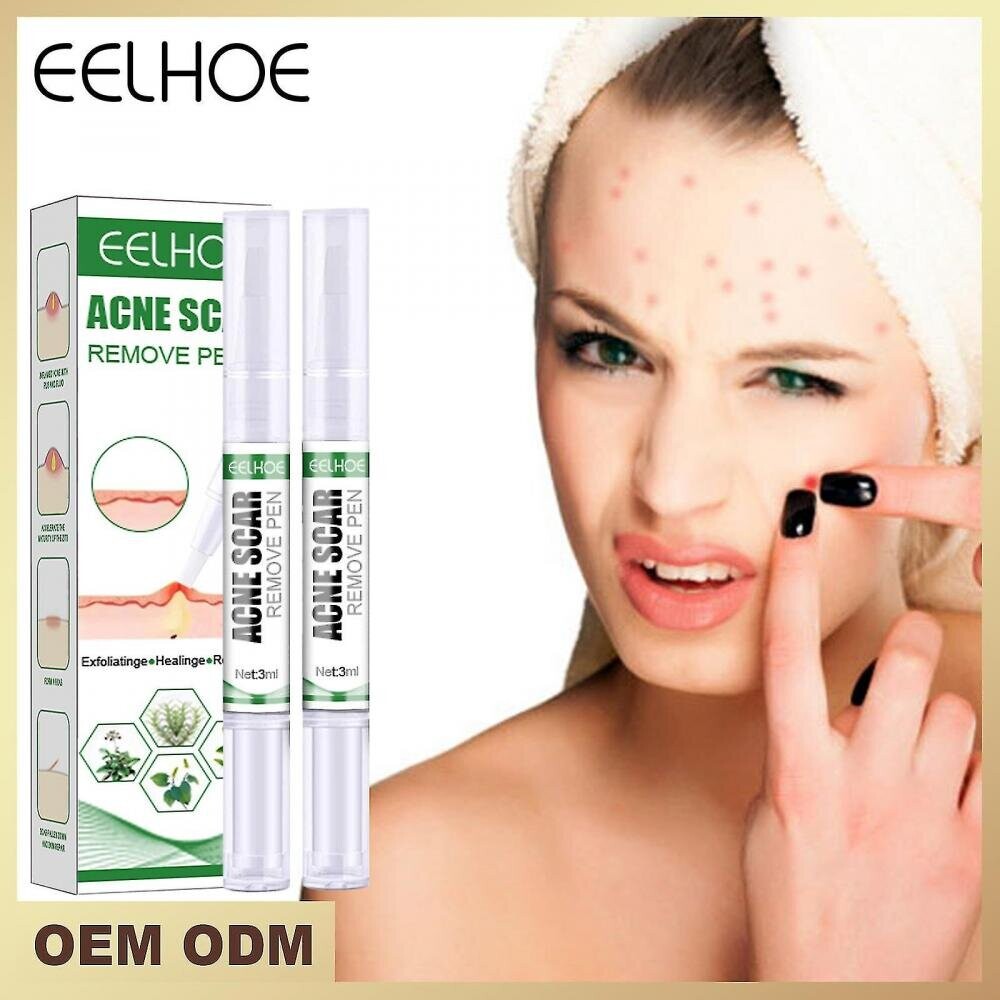 Eelhoe Acne Pen Gently Cleanses And Removes Pimples And Occlusions To ...