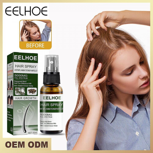 Hair Growth Spray Nourish Nourish Hair Roots Hair Care Anti Hair Fall ...