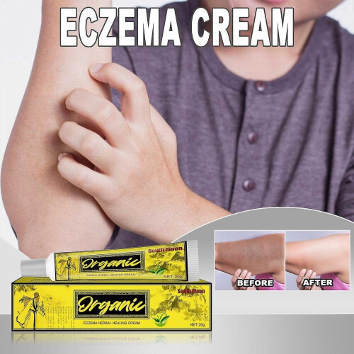 Herbal Ringworm Treatment Cream 20g Fights Ringworm On Body Powerful ...