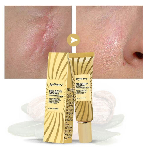 Acne Scar Removal Cream Remove Acne Scars Stretch Marks Burns Gel