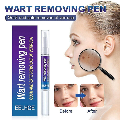 Skin Tags Amp; Wart Remover Pen Natural Ingredients Safe And Mild Wart ...