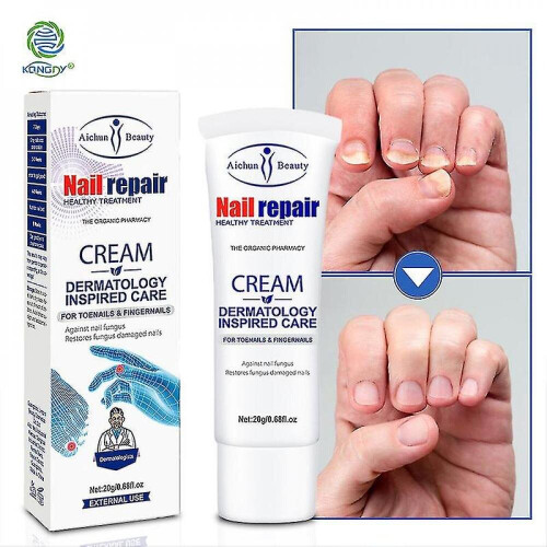 Ringworm Of The Nails 20g Antifungal Nail Ointment Toenail Fungus ...