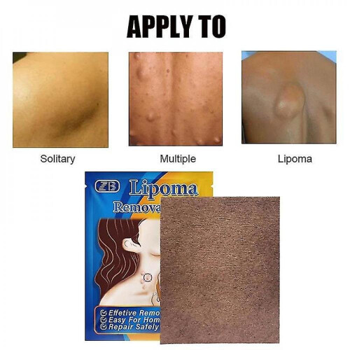 Tib Lipoma Removal Sticker Anti-tumor Peeling Pain Relief Patch Fat ...