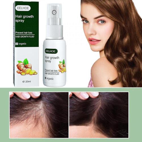Eelhoe Ginger Hair Growth Liquid on OnBuy
