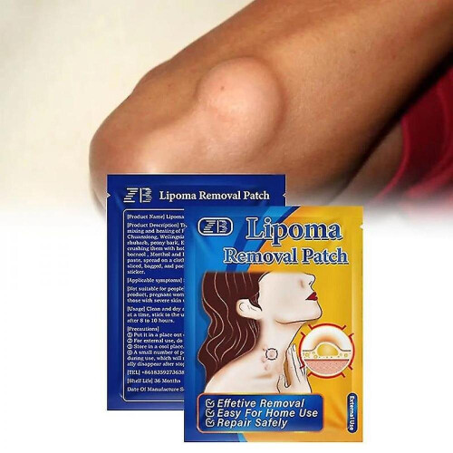 Tib Lipoma Removal Sticker Anti-tumor Peeling Pain Relief Patch Fat ...