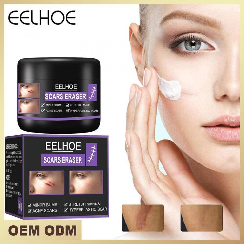 Eelhoe Scar Cream Fades Old Scars From Burns, Acne Pits And Marks ...