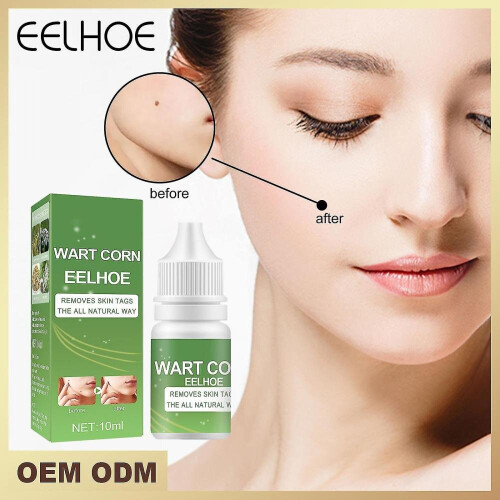 Mole Removal Potion Skin Removal Dark Spot Fade Melanin Face Removal No ...