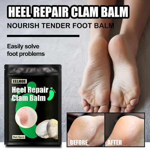 Eelhoe Foot Repair Clam Cream Repairs Dry Cracking Peeling Hydration ...