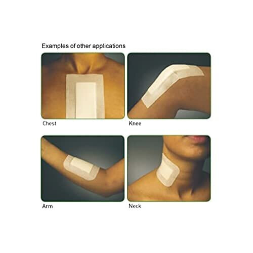 Large Adhesive Sterile Wound Dressings **Pack of 25**- Suitable for ...