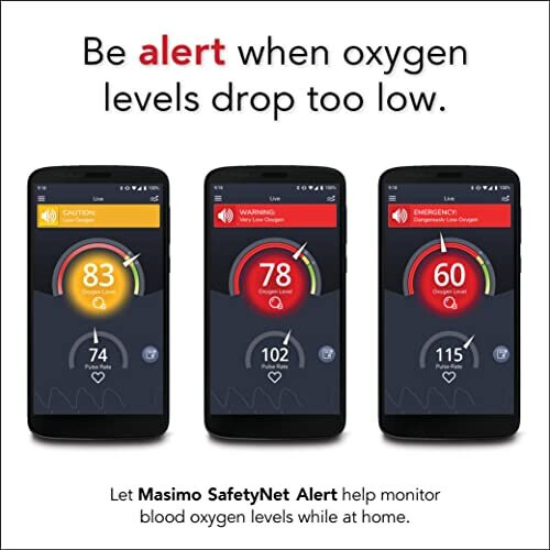 Masimo SafetyNet Alert - Oxygen Monitoring & Alert System, Wearable ...