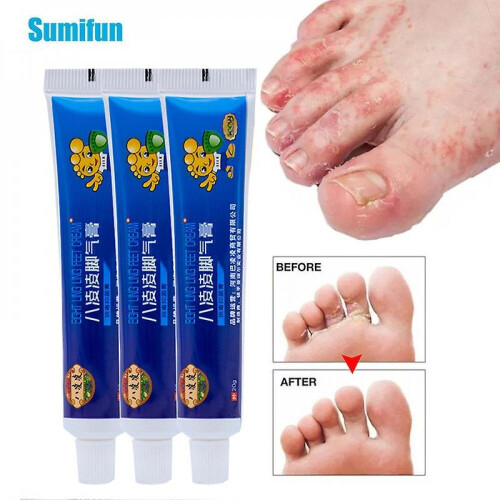 3pcs 's Foot Cream Remove Foot Anti-itng Antil Ing Blisters Care ...
