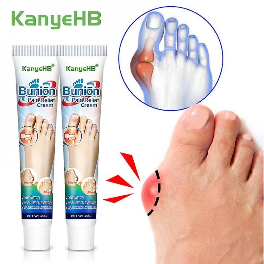 2pcs Bun Pain Relief Cream Toe Ux Vaus Treat Toe Periostitis Gout Foot ...