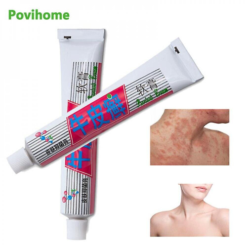 Skin Psoriasis Cream Dermatitis Eczematoid Pruritus Anti Itng Antil ...