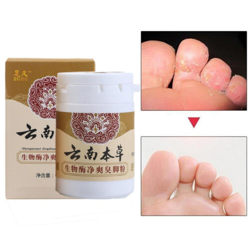 Herbal Extract Fungus Combat Feet Powder Anti Fungal Infections Athlete ...