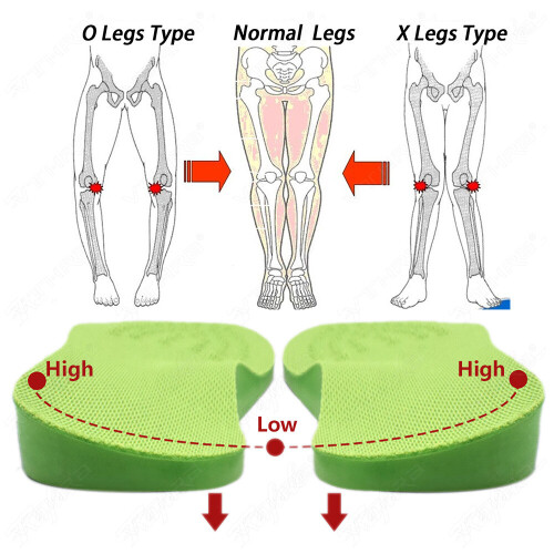 Latest O/X Leg Orthopedic Insole Correction Shoe Insert For Foot ...