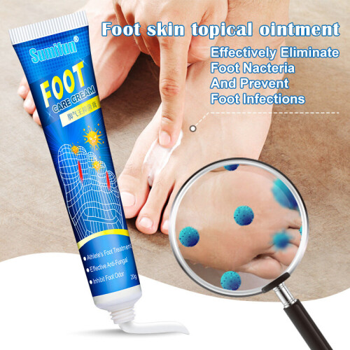 Hot Anti Fungal Infections Foot Cream for Athlete's Foot Pain Relief ...