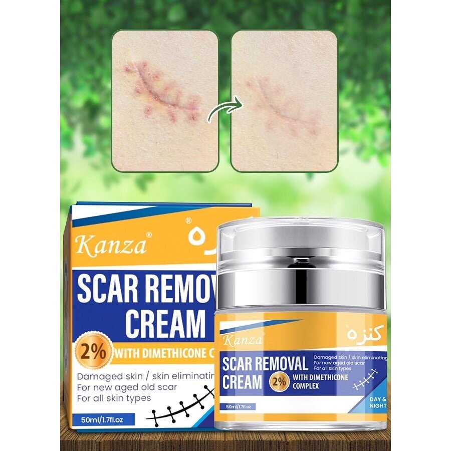 Kanza 50ml Scar Removal Cream for Damaged Skin Dead Skin Cream Herbal ...