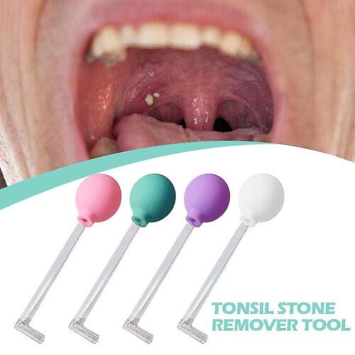 (purple) Tonsil Stone Remover,tonsil Stone Removal Tool Kit,tonsil ...