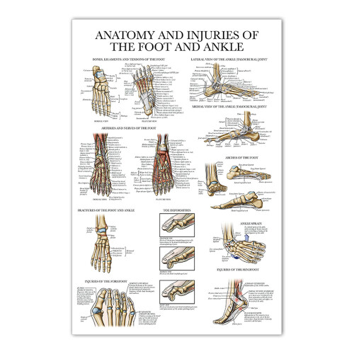 (30x40cm(12x16inches), #19 Anatomy & Injuries of the Foot and Ankle ...