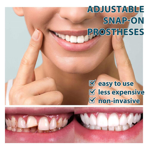 2X Adjustable Snap-on Dentures, Veneers Denture Braces Plus Denture ...