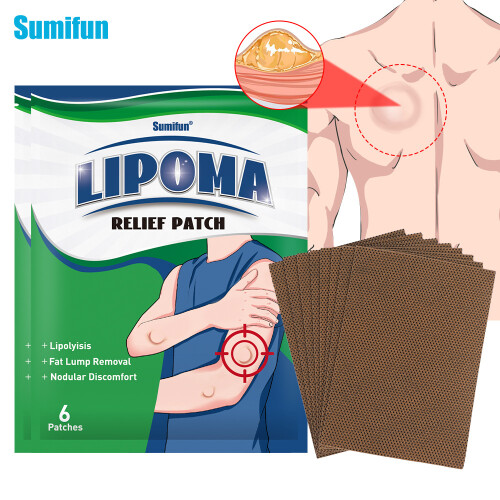 Lipoma patch, fat particle agglomeration patch on OnBuy