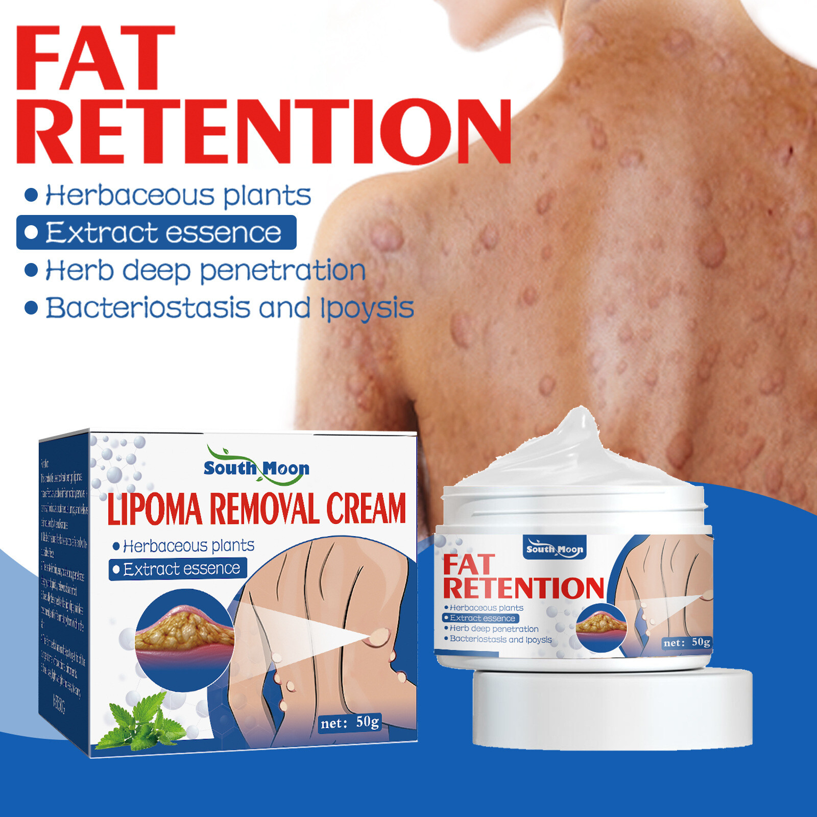 Fatty knot cream relieves fat lumps, lumps and bumps, eliminates fat ...