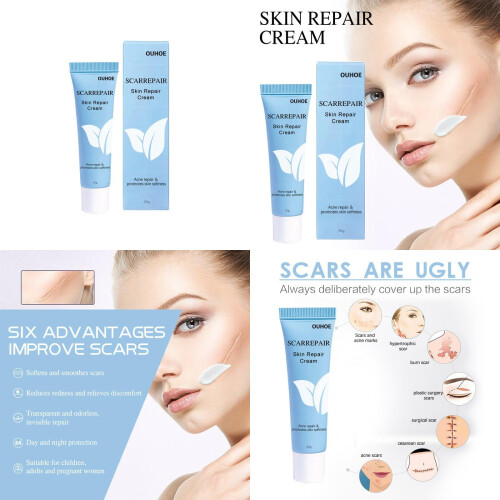 Scar Skin Ouhoe Repair Cream Moisturizing Formula For Smoothing ...