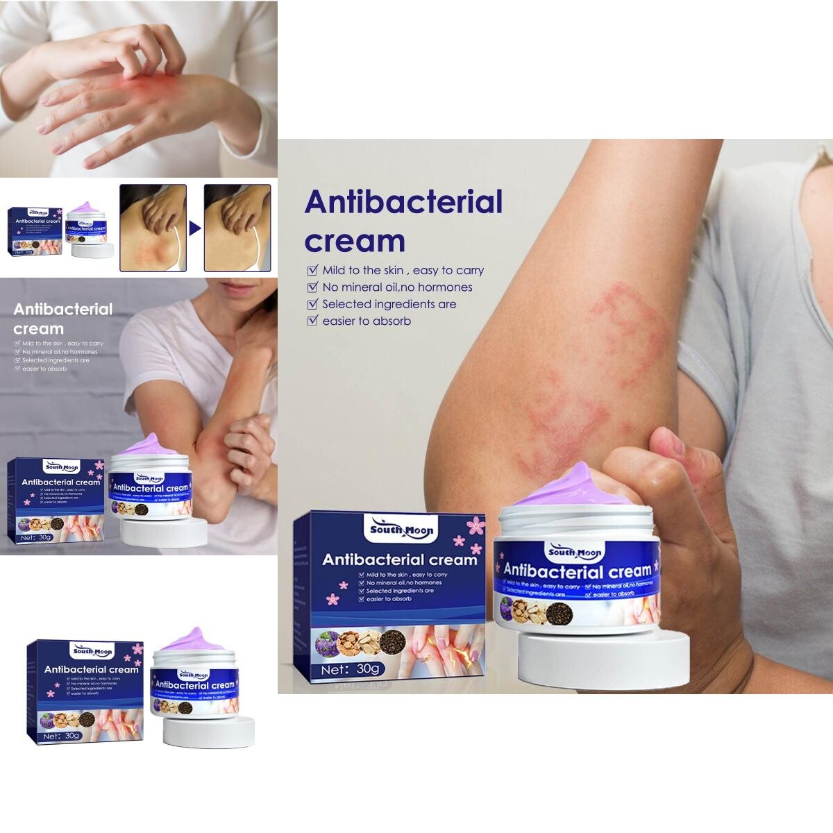 South Moon Herbal Itch Relief Cream For Skin Rashes And Bug Bite ...