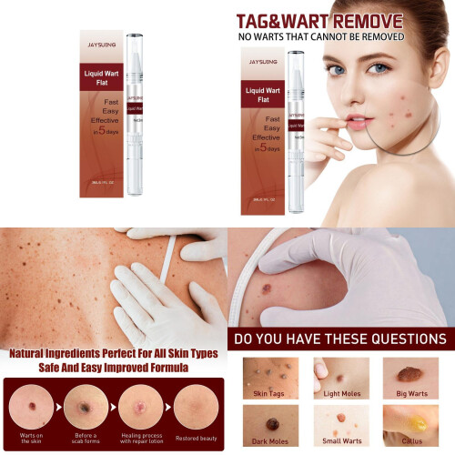 Premium Jaysuing Skin Wart Removal Pen For Effective Treatment Of Skin ...