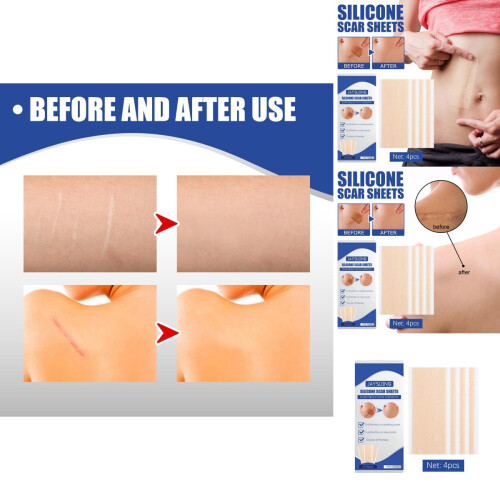 Innovative Jaysuing Silicone Scar Patches For Smooth Skin And Reducing ...