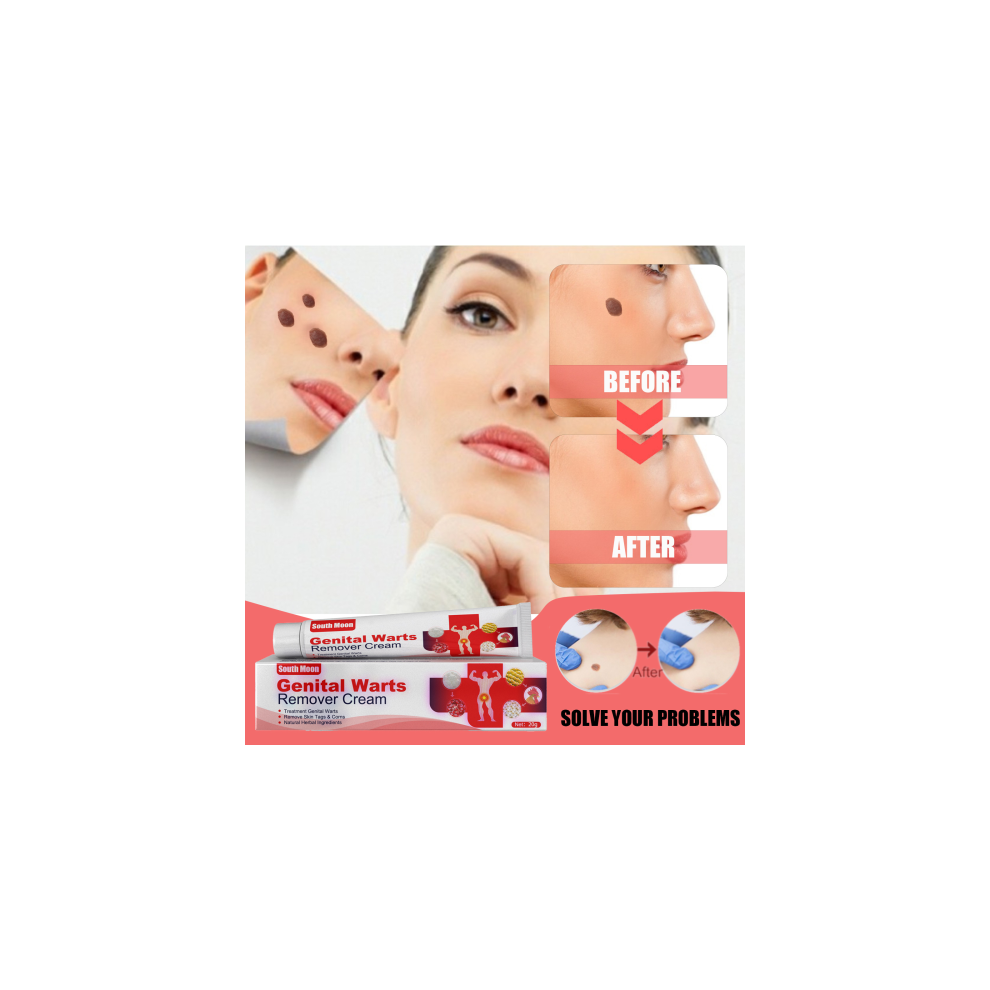 Genital Herpes Wart Remover Ointment Skin Tag Mole Cream 20g on OnBuy