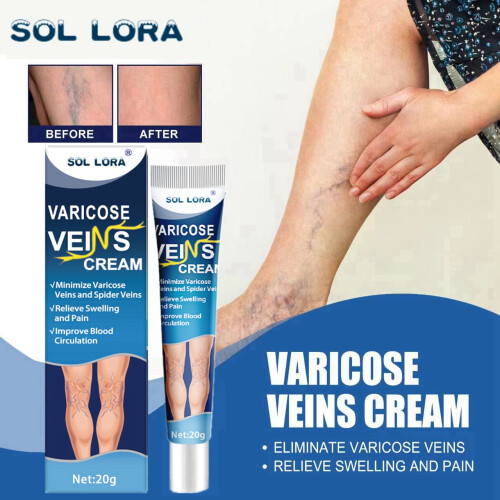 Vein Massage Vocerebral Cream Repair Cream For Relieving Veins In The ...