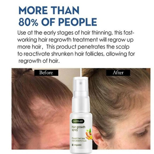 Ginger Anti Hair Loss Hair Growth Spray Essential Oil ReGrowth Ginger ...