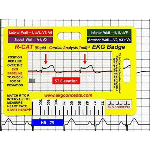 R-CAT EKG Badge Card Accurately Interpret ECG / EKG Rhythm Strips and ...
