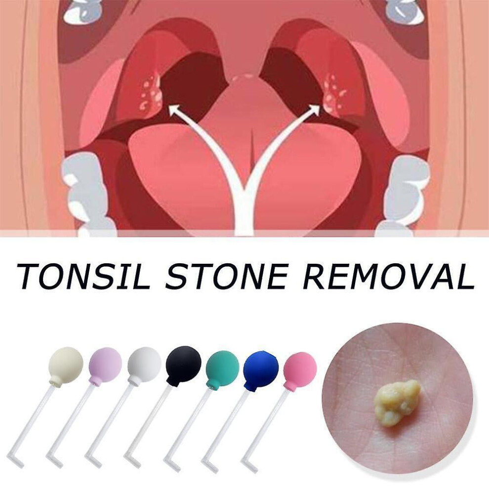 (Blue) Tonsil Stone Remover,tonsil Stone Removal Tool Kit,tonsil Stone ...