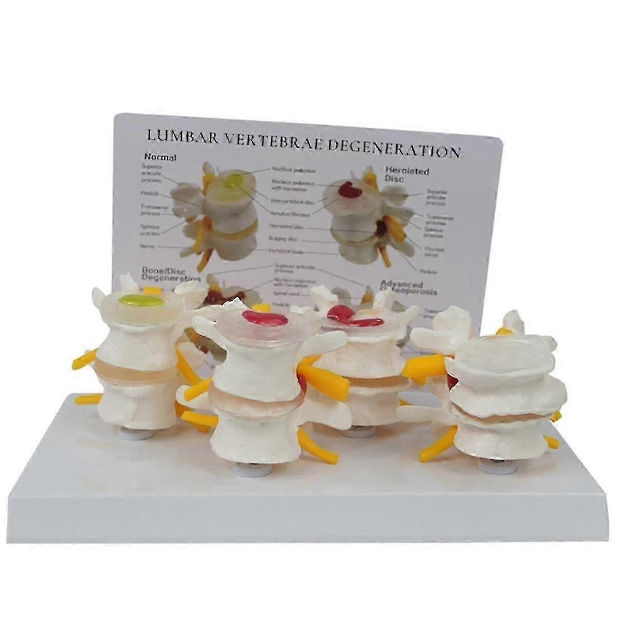 Four Stage Vertebrae Model, Human Anatomy and Physiology Educational ...